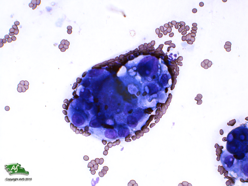 Dog, Subcutis: Carcinoma - Veterinary Pathology & Cytology - VetSurgeon ...