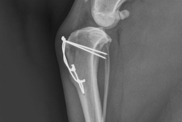 CrCl Rupture With Medial Patellar Luxation Option Is TPLO , 54% OFF CrCl Rupture With Medial Patellar Luxation Option Is TPLO , 54% OFF