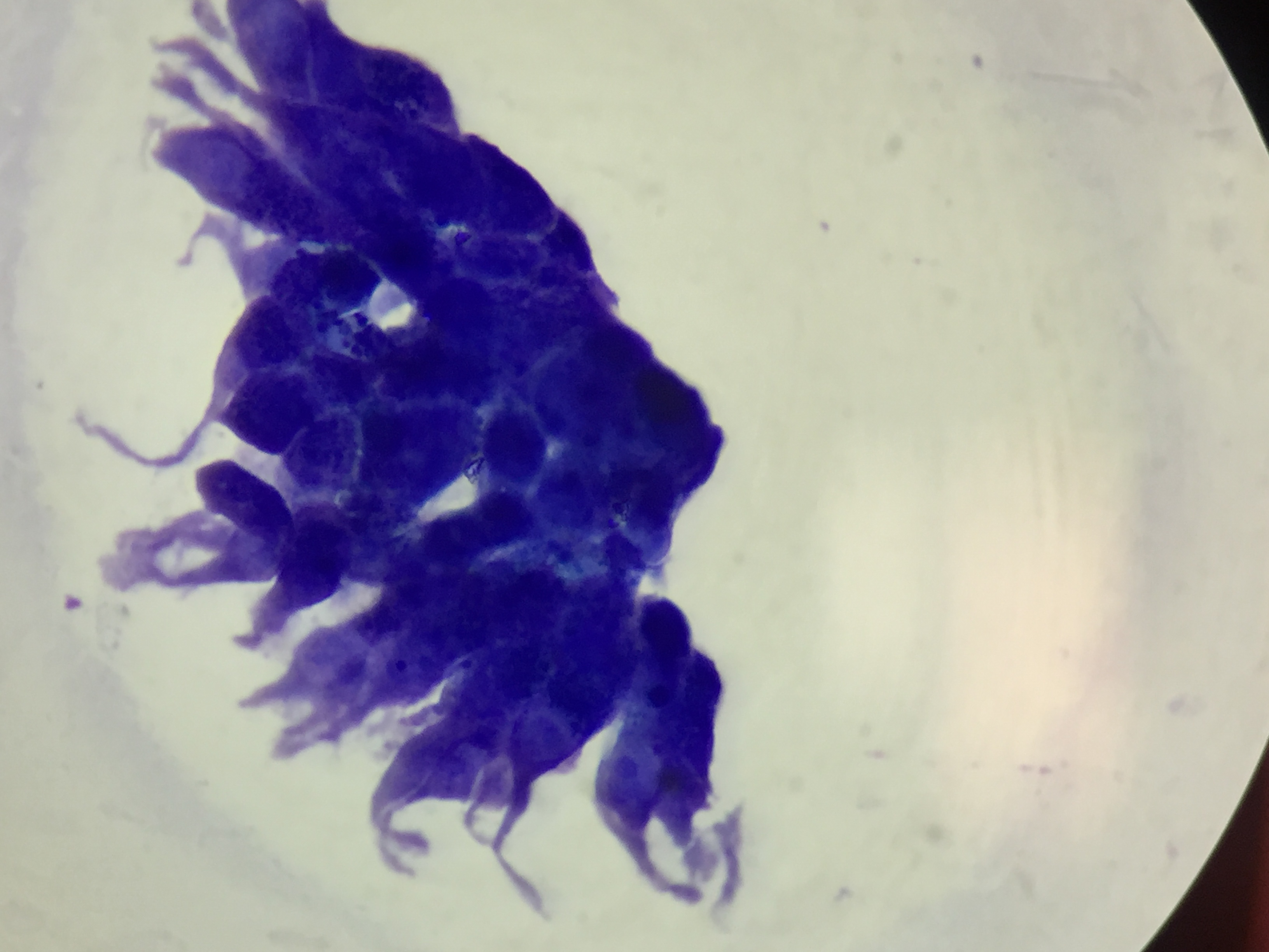 Soft tissue sarcoma - Veterinary Pathology & Cytology - VetSurgeon.org ...