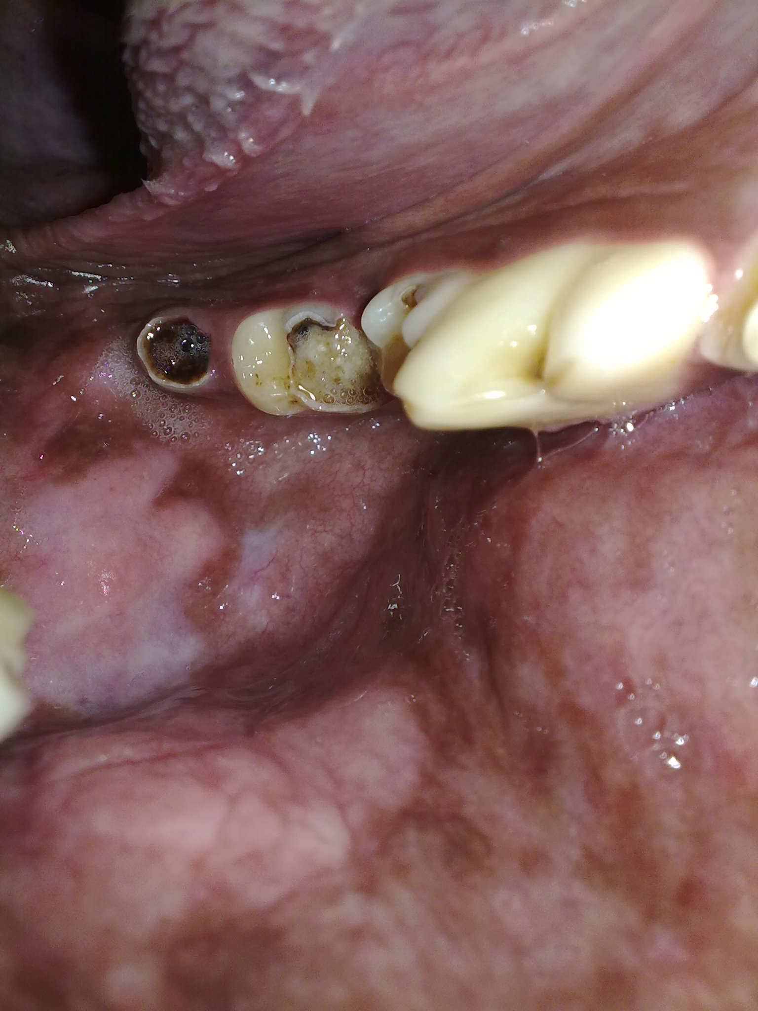 Caries - Veterinary Dentistry and Oral Surgery - VetSurgeon.org ...