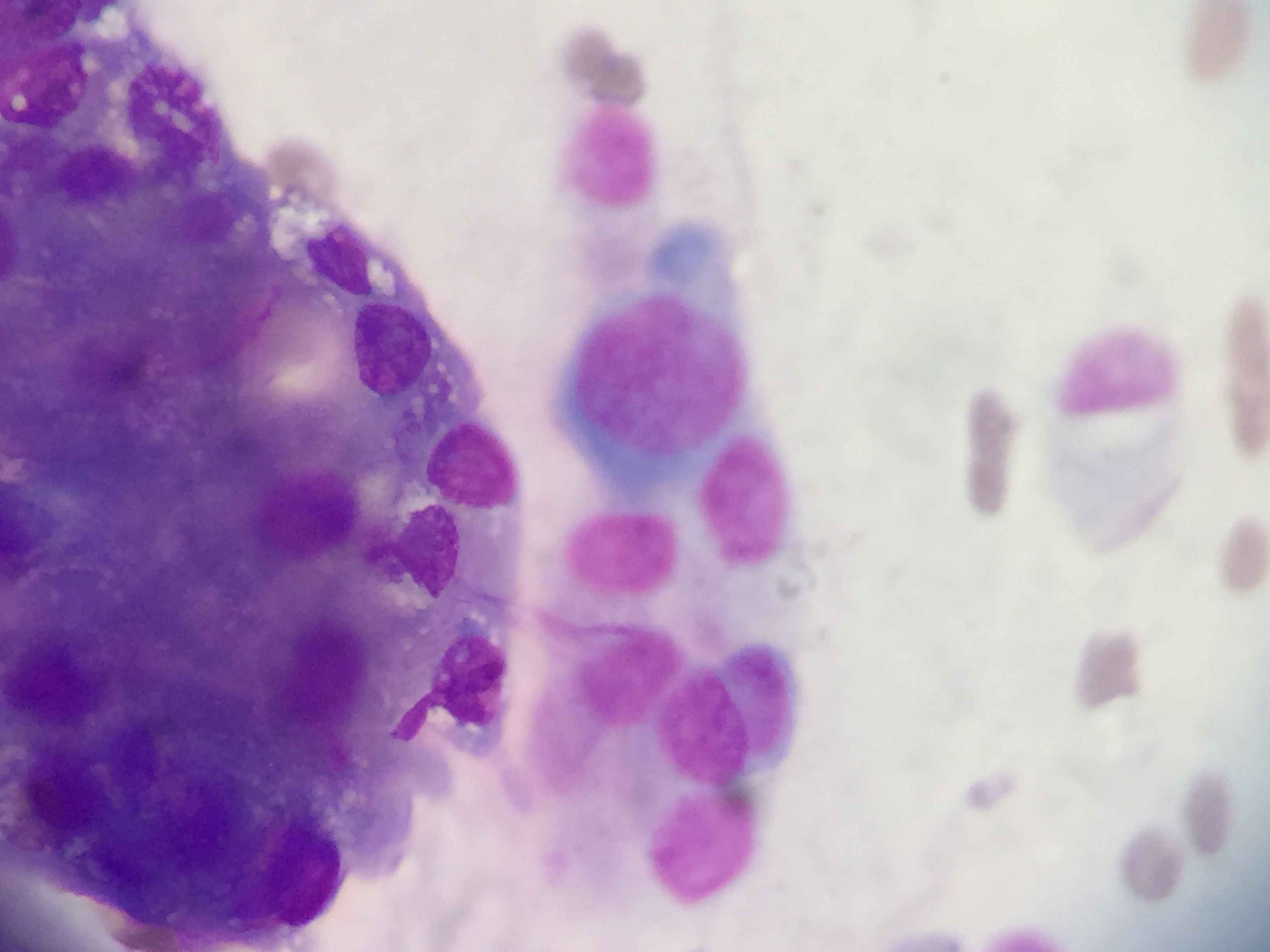 Bronchial mass impression smear - Veterinary Pathology & Cytology ...